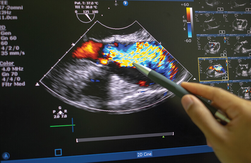 ECHOCARDIOGRAPHY: A WINDOW TO YOUR HEART | Nicolet College